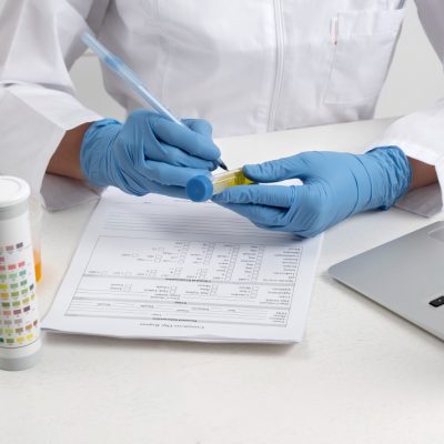 Vitamin Deficiency Test For Fatigue And Brain Fog