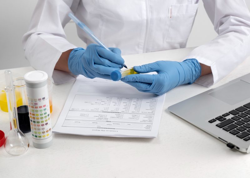 Vitamin Deficiency Test For Fatigue And Brain Fog